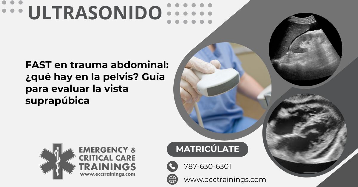 FAST en trauma abdominal: ¿qué hay en la pelvis? Guía para evaluar la ...
